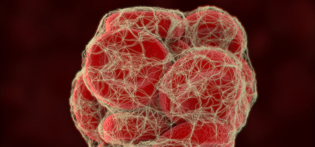 What is the role of blood clotting in lung cancer?